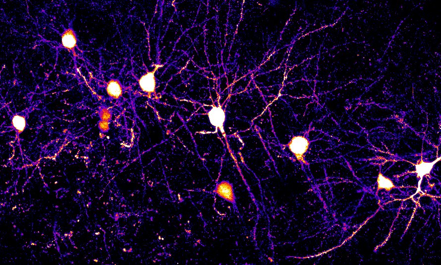 Synapses in neurons do not follow a single strategy